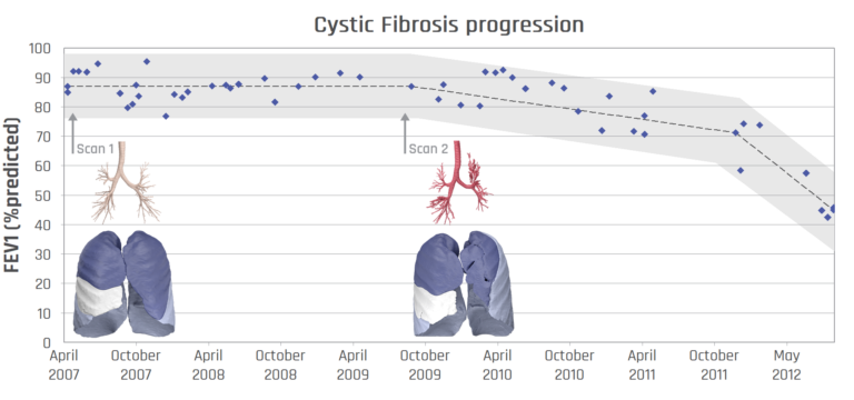 Lung Imaging | FRI | Fluidda.com : Fluidda