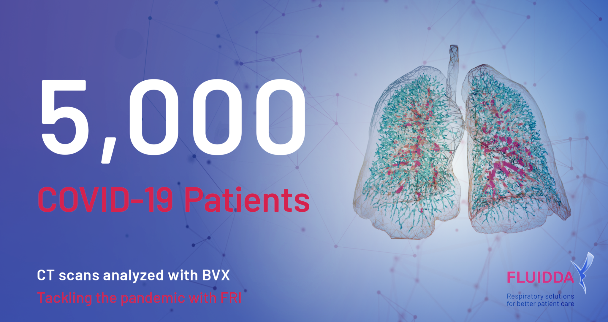 Over 5000 COVID-19 patients already analyzed with Fluidda's new blood ...